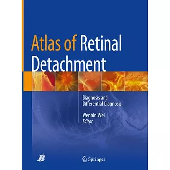 博客來-Atlas of Retinal Detachment: Diagnosis and Differential Diagnosis