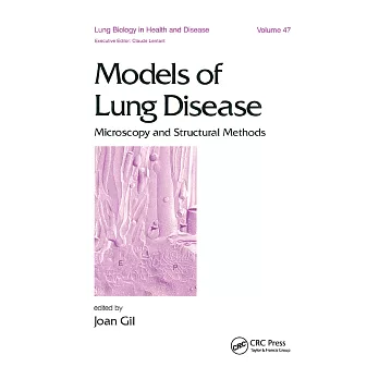 博客來-Models of Lung Disease