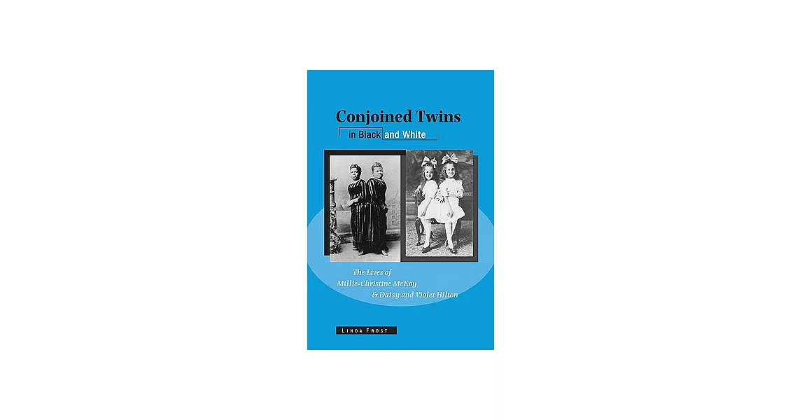 博客來-Conjoined Twins in Black and White: The Lives of Millie-Christine ...