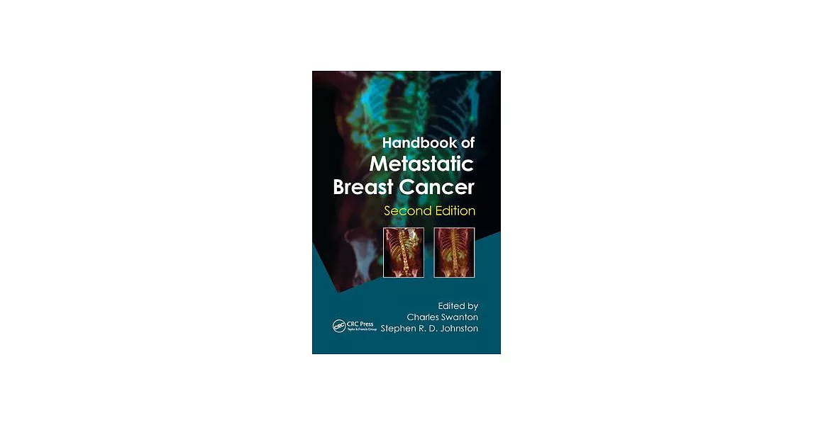 博客來-Handbook of Metastatic Breast Cancer