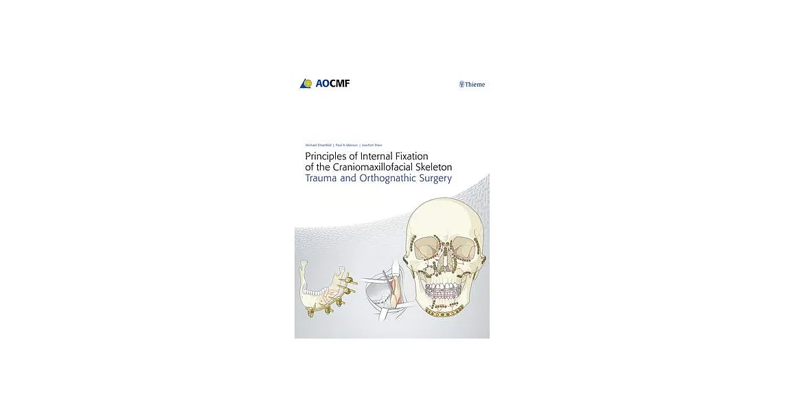 博客來-Principles of Internal Fixation of the Craniomaxillofacial Skeleton ...